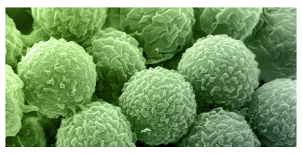 Mold Colonized | Healthy Building Science, Inc.